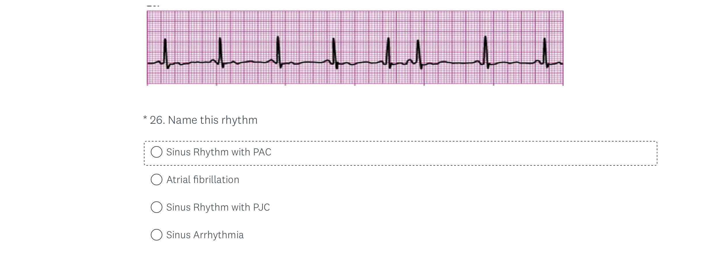 Solved Use the EKG strips to answer the questions below each | Chegg.com