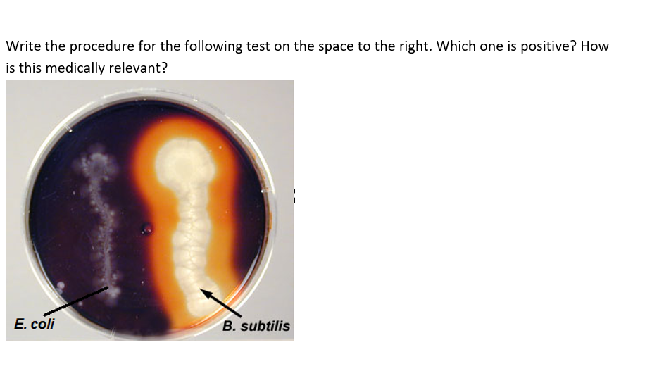 Solved Write the procedure for the following test on the | Chegg.com