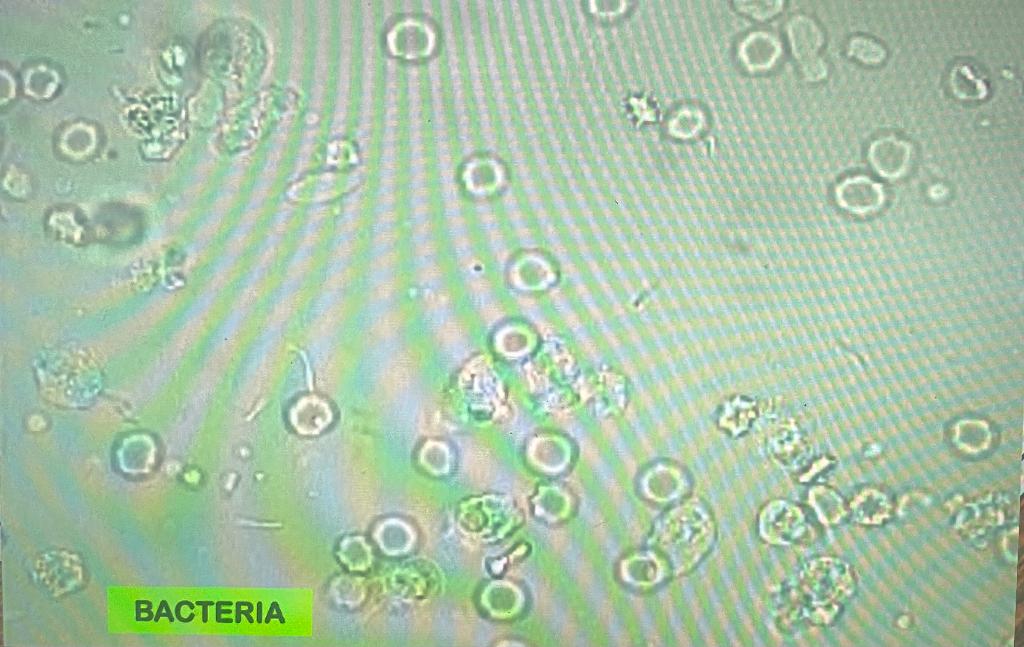 Solved BACTERIA | Chegg.com