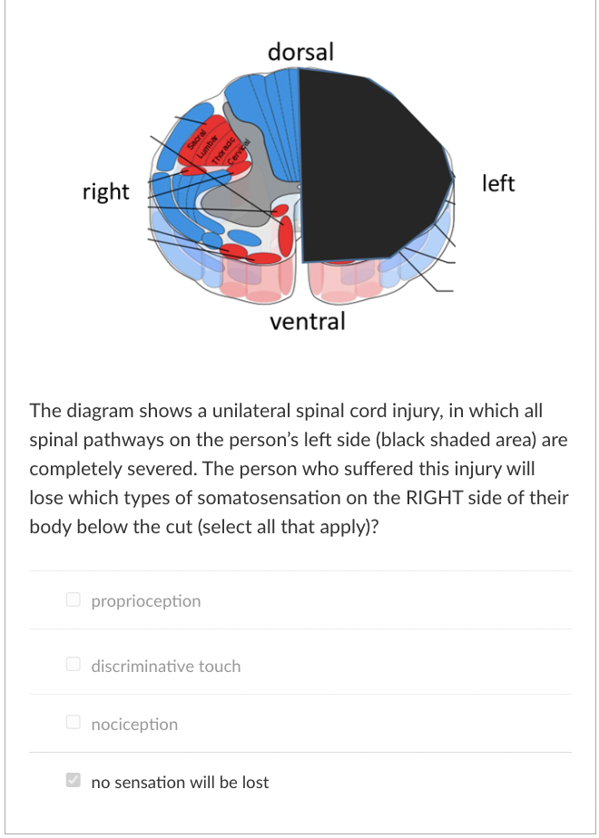 Solved The diagram shows a unilateral spinal cord injury, in | Chegg.com