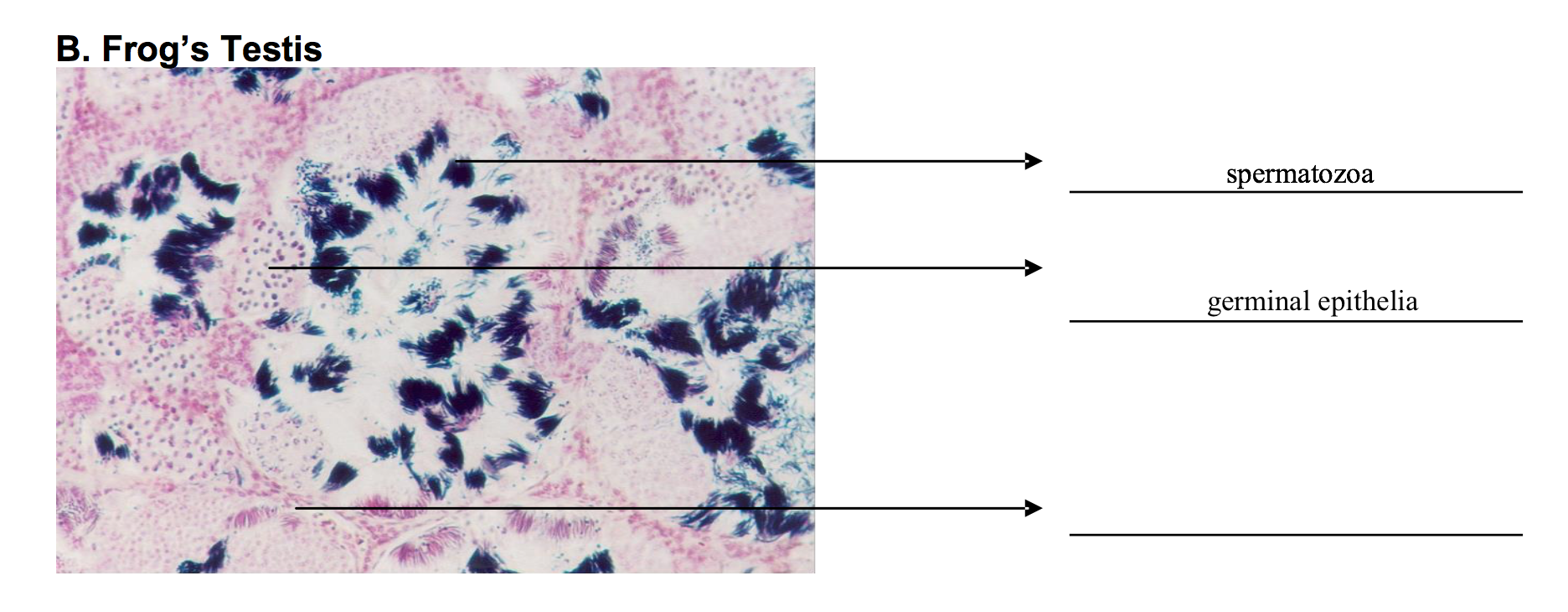 Solved B. Frog's Testis spermatozoa germinal epithelia | Chegg.com