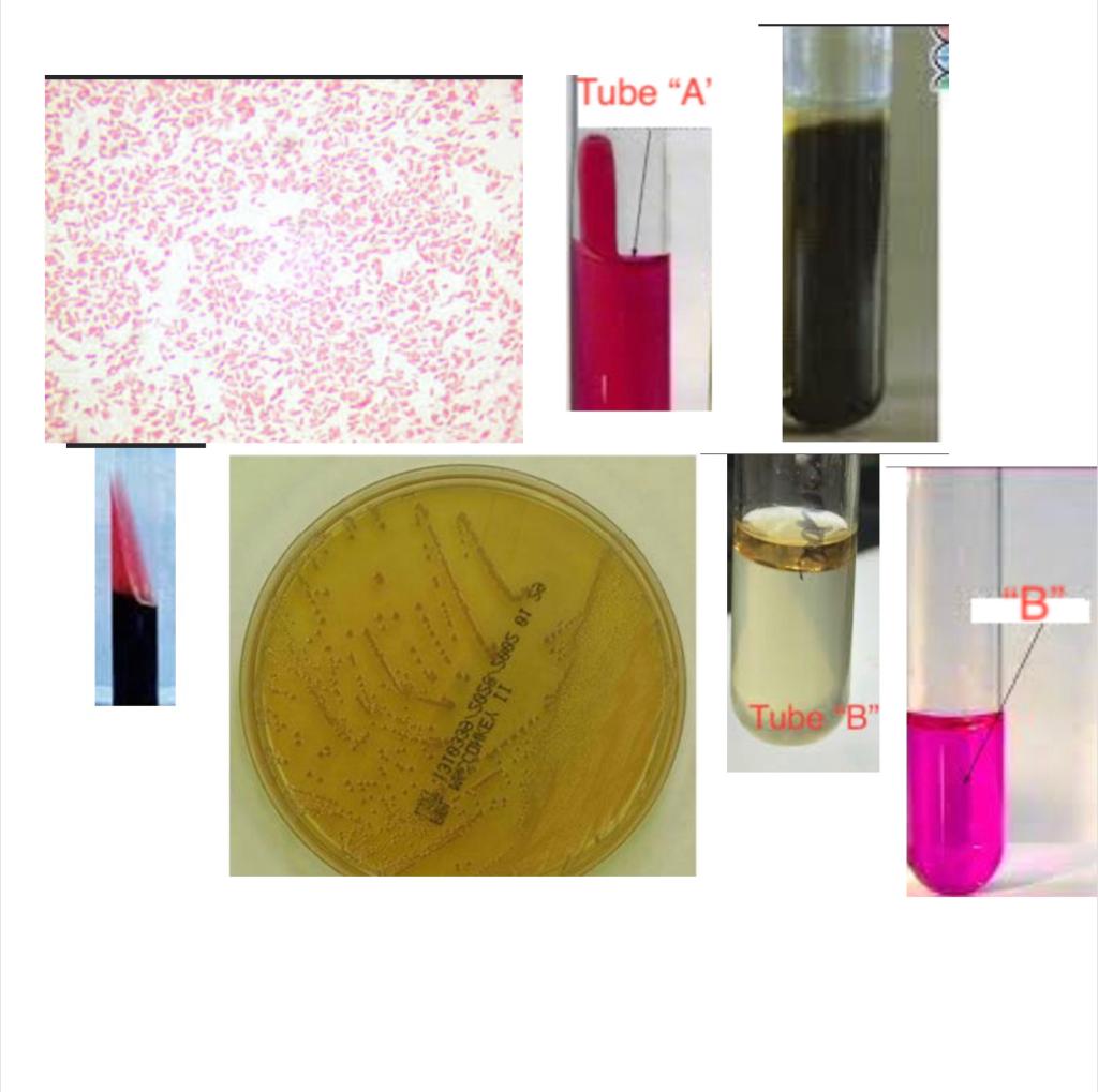 Solved What is this mystery enteric? Please develop a | Chegg.com