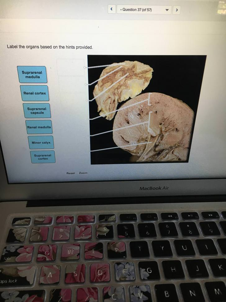 Solved Question 37 (of 57) Label the organs based on the | Chegg.com