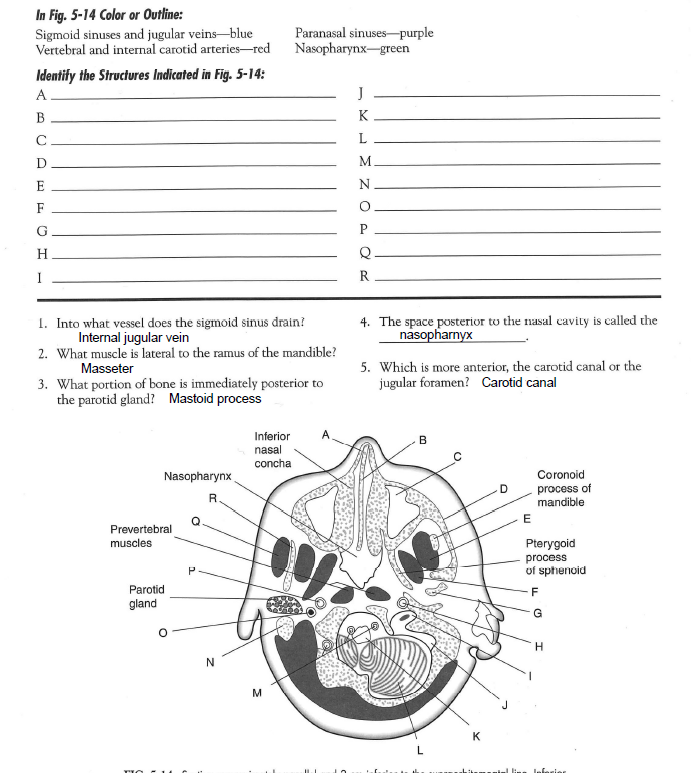 Solved In Fig. 5-14 Color or Outline: Sigmoid sinuses and | Chegg.com