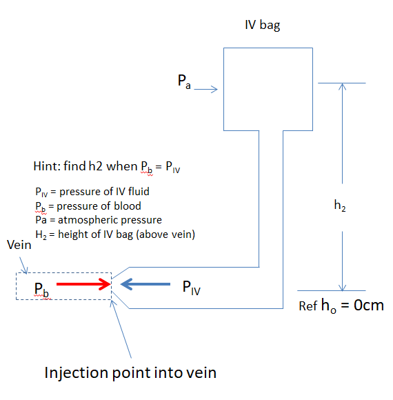 Solved An IV (intravenous injection) is a type of gravity | Chegg.com