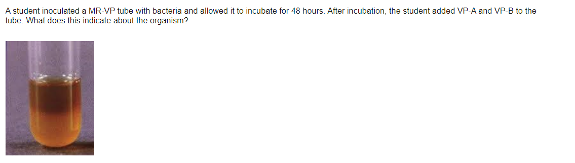 Solved A student has inoculated a MR-VP tube with bacteria | Chegg.com