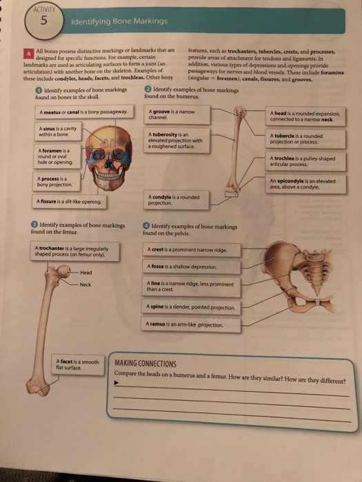 Solved Classifying Bones According to Location Bones can be | Chegg.com