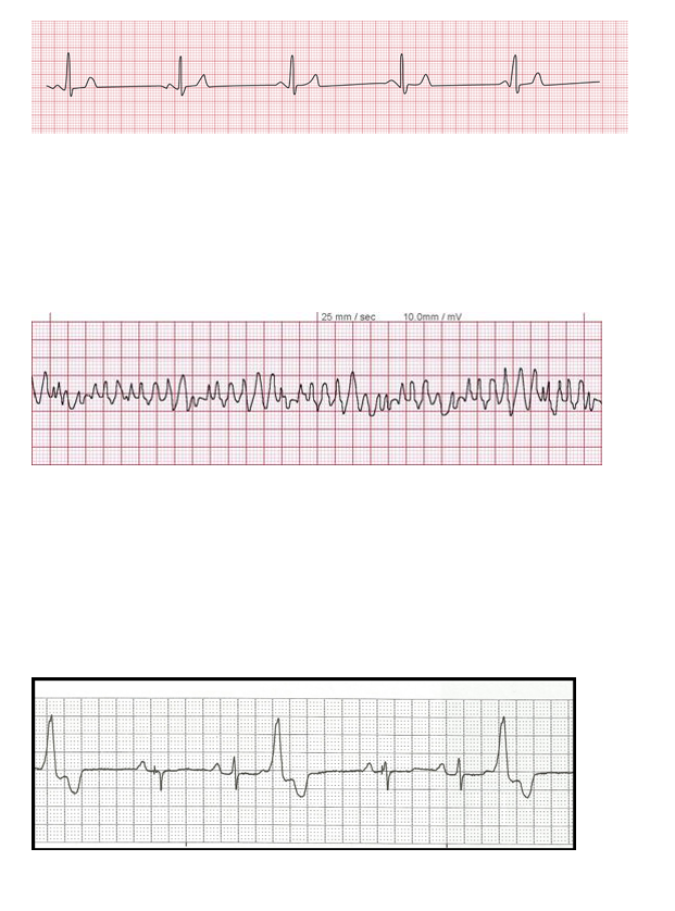 Solved For each of these rhythms: Name the rhythm, Describe | Chegg.com