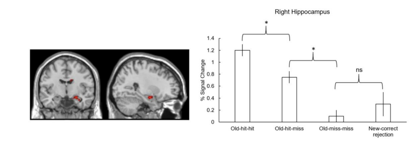 Solved During the encoding phase of a memory experiment, | Chegg.com