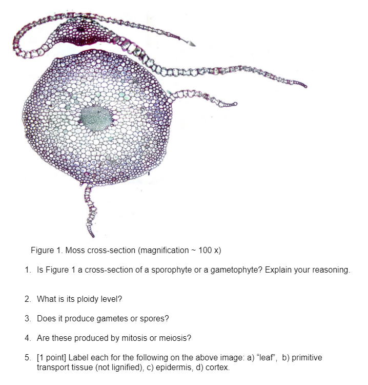 Solved Figure 1. Moss cross-section (magnification - 100 x) | Chegg.com