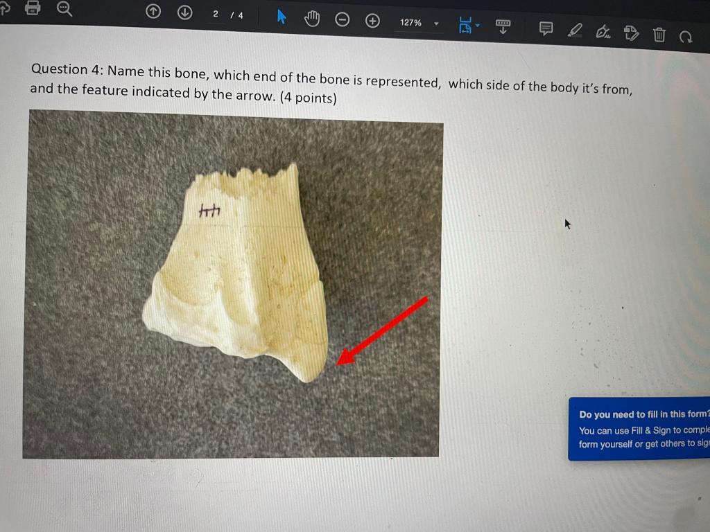 Solved Question 4: Name this bone, which end of the bone is | Chegg.com