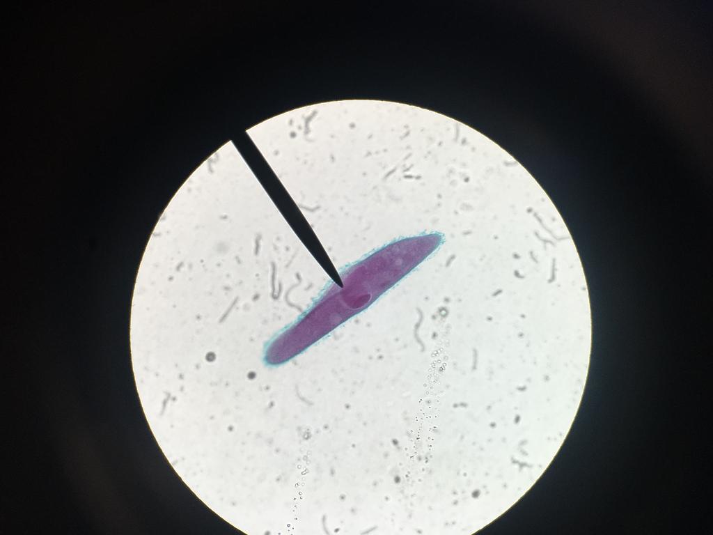 Solved Paramecium Ulothrix Claviceps purpurea | Chegg.com