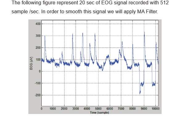 The following figure represent 20 sec of EOG signal | Chegg.com