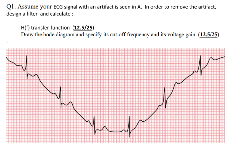 Solved Q1. ﻿Assume your ECG signal with an artifact is seen | Chegg.com