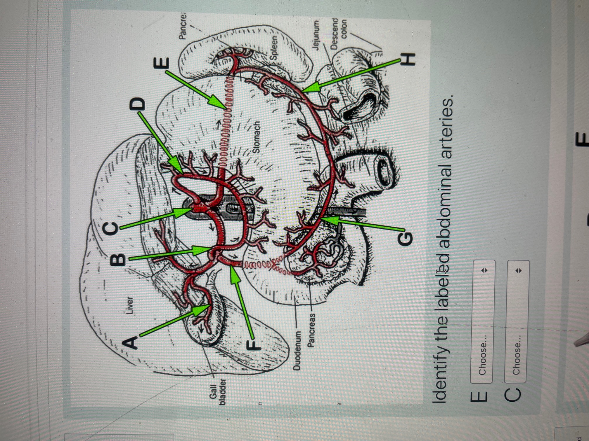 Solved Identify the labelied abdominal arteries. | Chegg.com