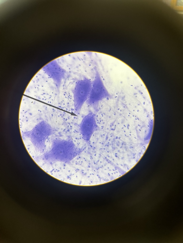 This is a picture of a neuron (nervous tissue) under | Chegg.com