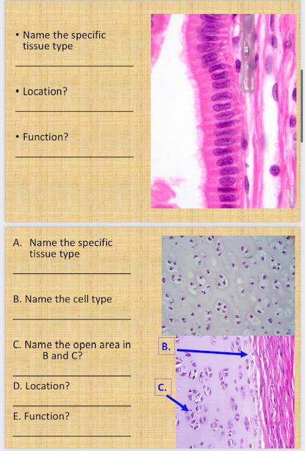 Solved • Name the specific tissue type • Location? • | Chegg.com