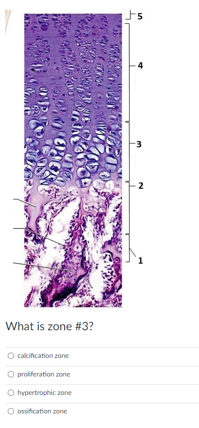 Solved t5 DE 4 -3 2 1 What is zone #3? O calcification zone | Chegg.com