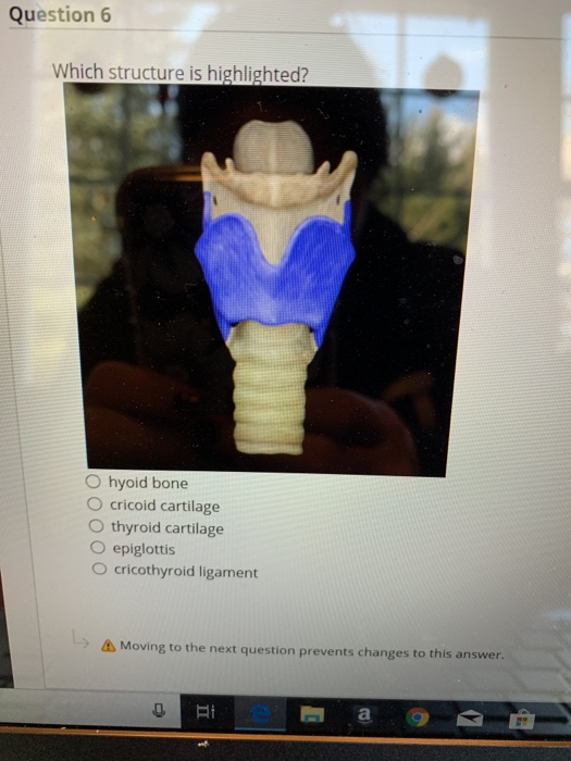 Solved Question 6 Which structure is highlighted? O hyoid | Chegg.com