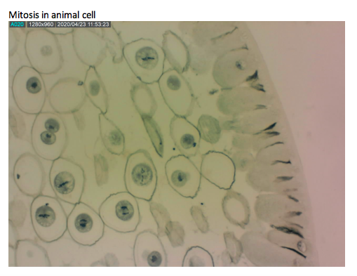 Stages Of Mitosis Under Microscope