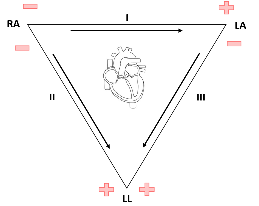 Solved We are given a 12-lead ECG, and we know that the | Chegg.com
