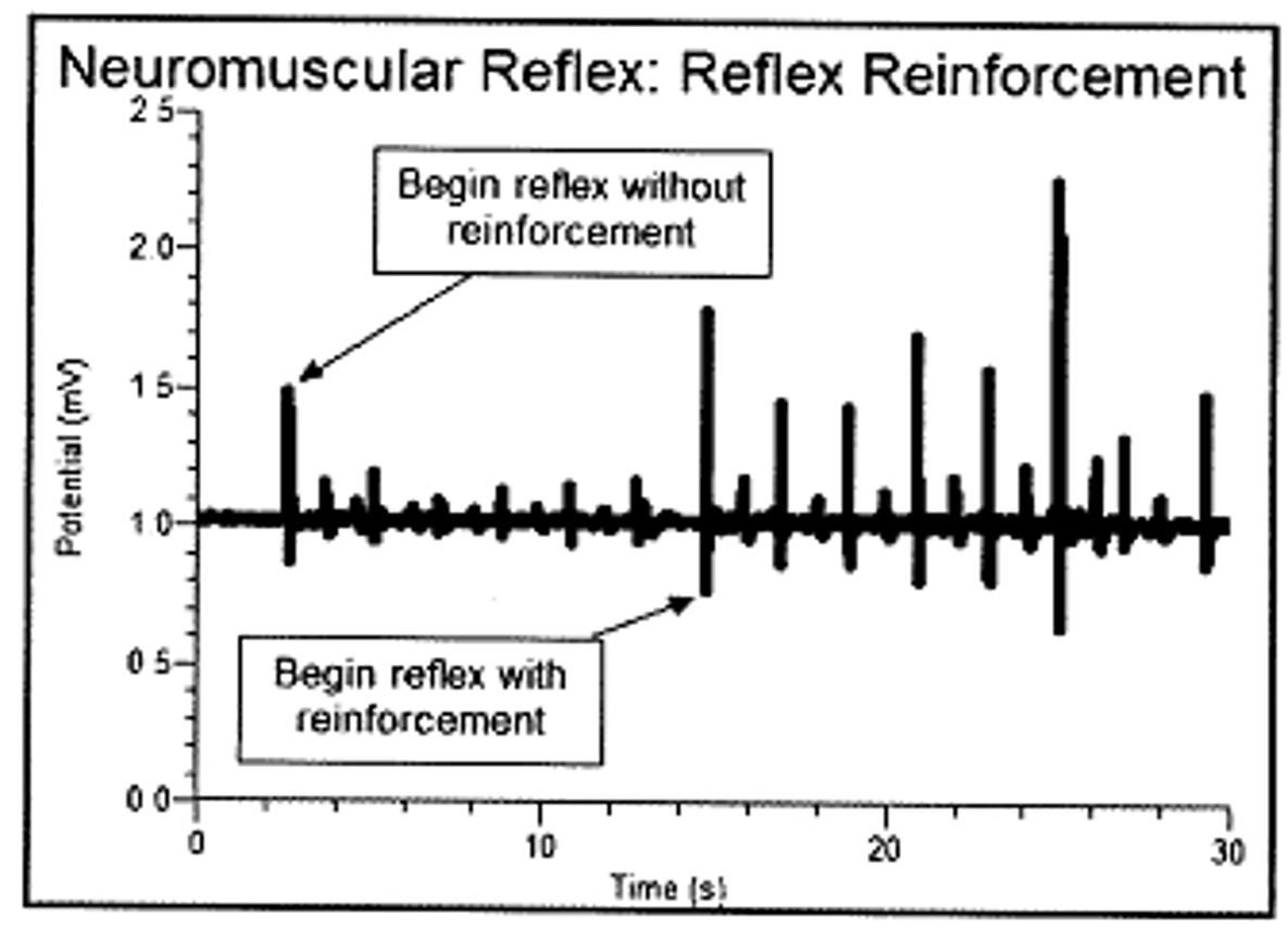 Solved Reflex without reinforcement Reflex with | Chegg.com
