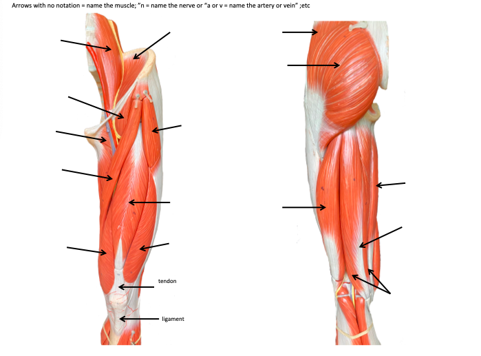 Solved ligament External iliaca Avn n n Arrows with no | Chegg.com