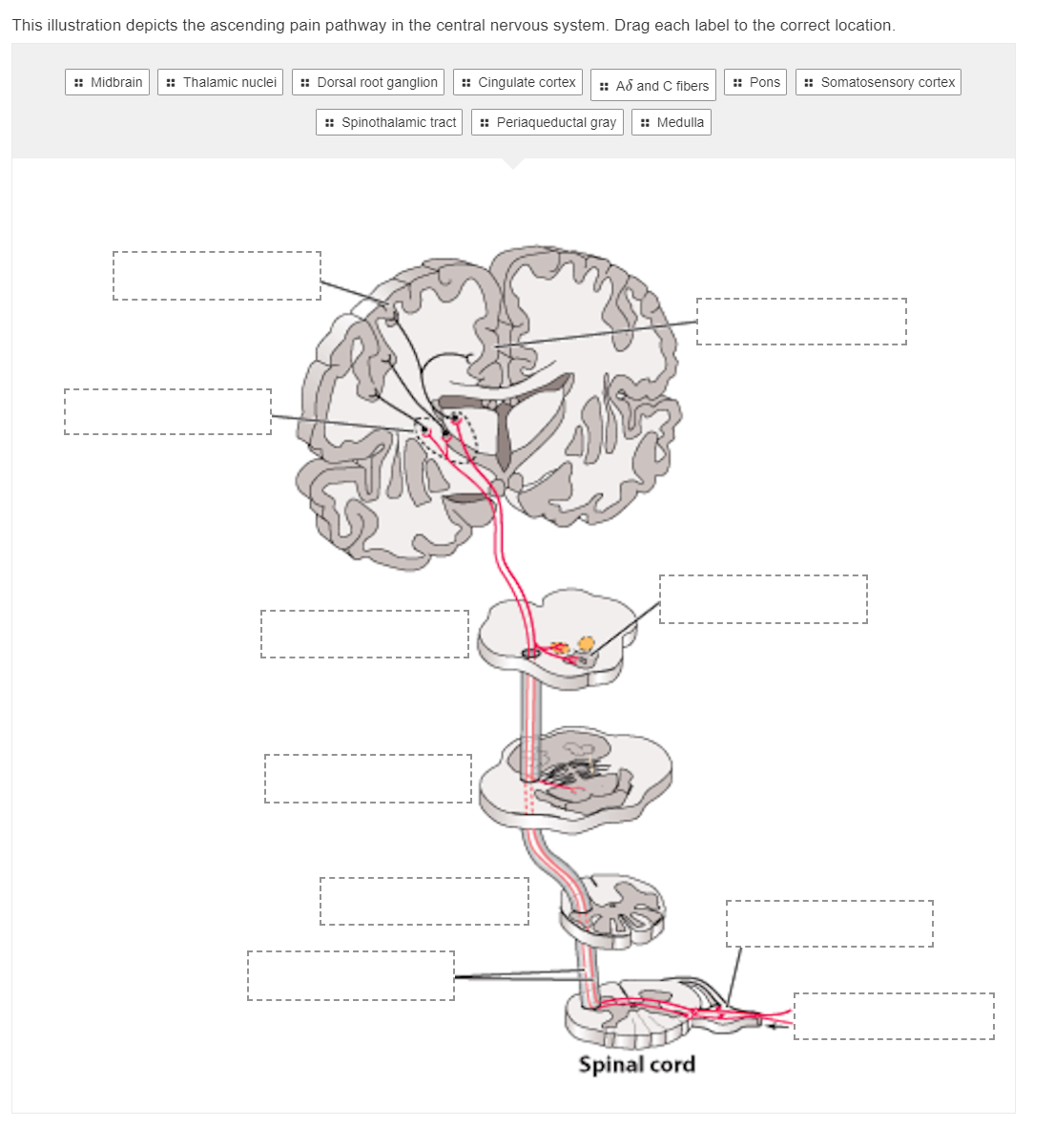 Solved This illustration depicts the ascending pain pathway | Chegg.com