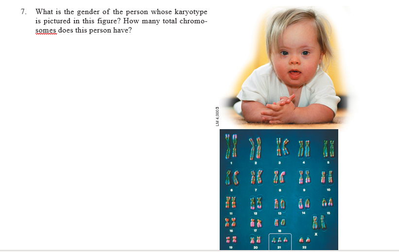 Solved 7. What is the gender of the person whose karyotype | Chegg.com