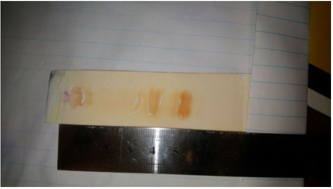 1. Based on the color of the TLC spots in Part 2, | Chegg.com