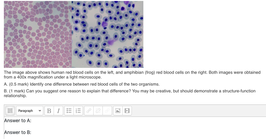 Solved The image above shows human red blood cells on the | Chegg.com