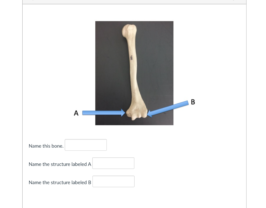 Name this bone. Is A or B the sternal side of this | Chegg.com