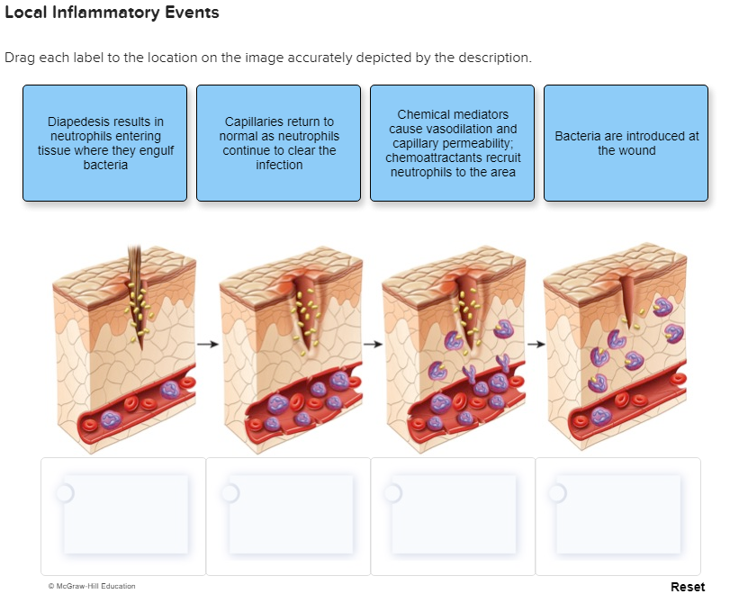 Solved Local Inflammatory Events: Drag each label to the | Chegg.com