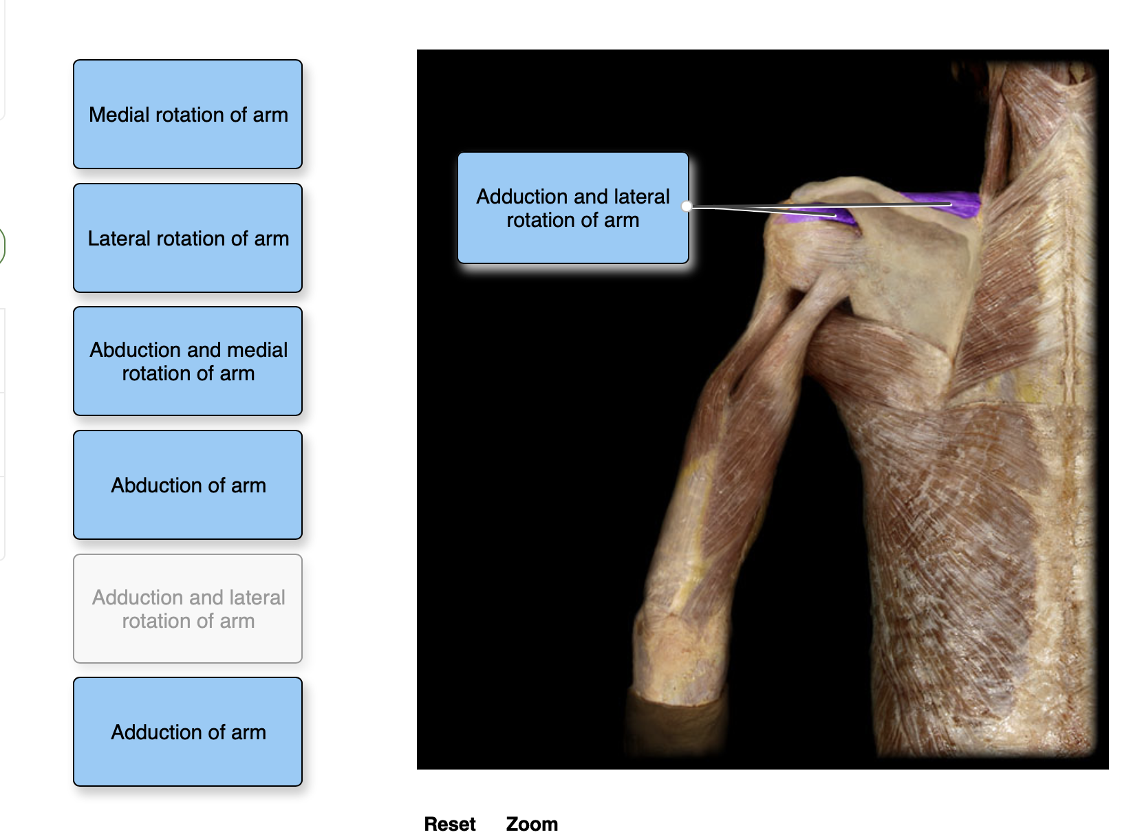 Solved Medial rotation of arm Lateral rotation of arm | Chegg.com