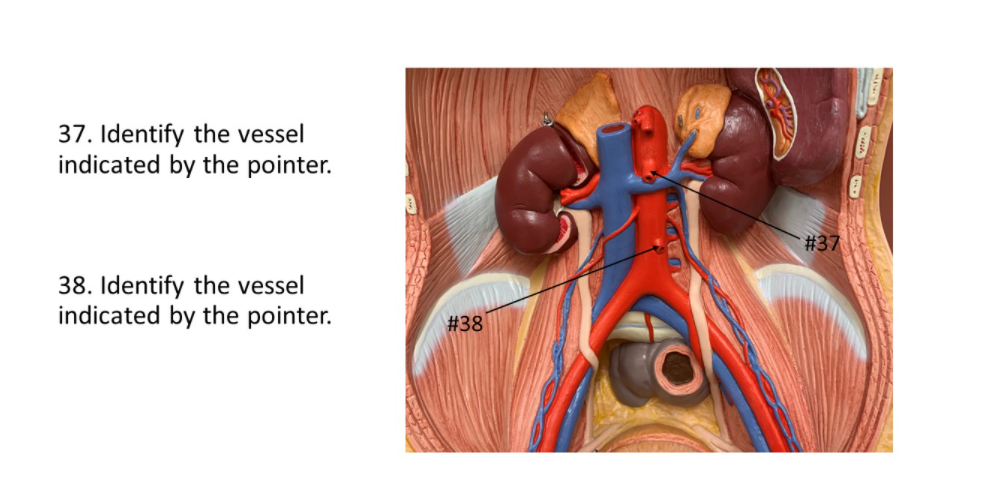 Solved 28. Identify the vessel indicated by the pointer. 29. | Chegg.com