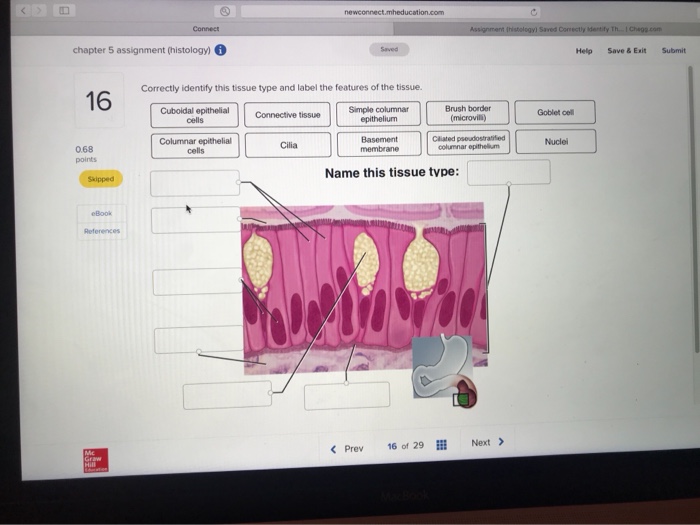 Solved Connect chapter 5 assignment (histology) Help | Chegg.com Solved Connect chapter 5 assignment (histology) Help | Chegg.com