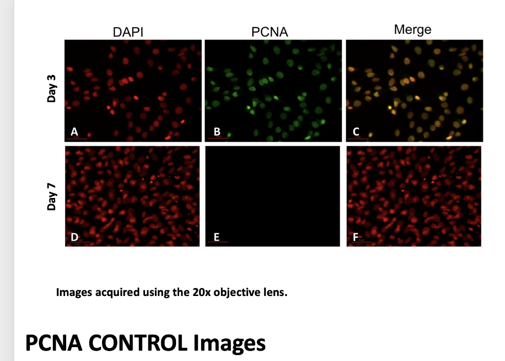 Solved DAPI PCNA Merge Day 3 A B C Day 7 D E F Images | Chegg.com