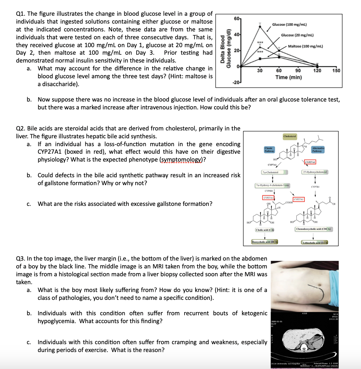 [Solved]: Q1. The figure illustrates the change in blood glu