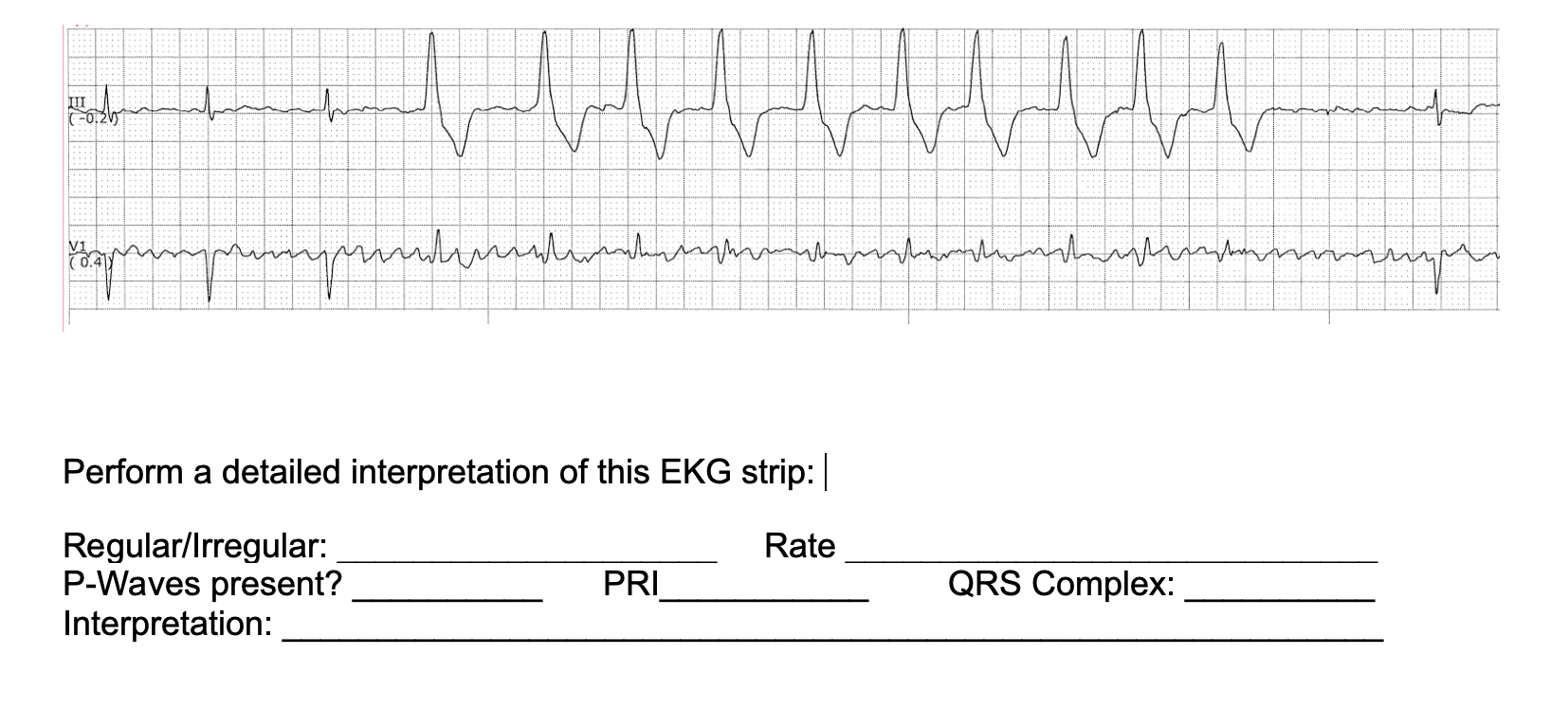 Solved Perform a detailed interpretation of this EKG | Chegg.com
