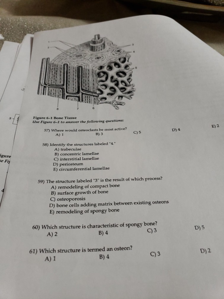 Solved 6 Figure 6-1 Bone Tissue Use Figure 6-1 to answer the | Chegg.com