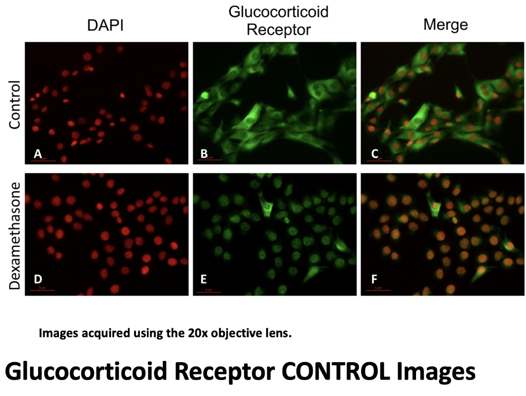 Solved DAPI PCNA Merge Day 3 A B C Day 7 D E F Images | Chegg.com
