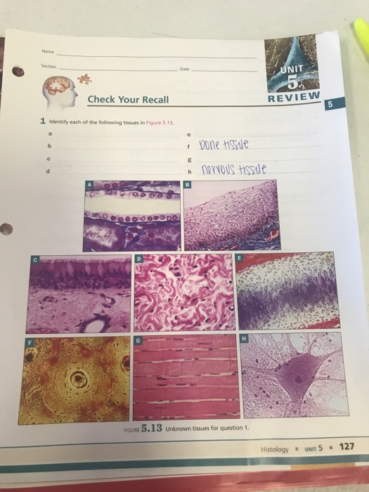 Solved Section NIT Check Your Recall REVIEW 1 identify each | Chegg.com
