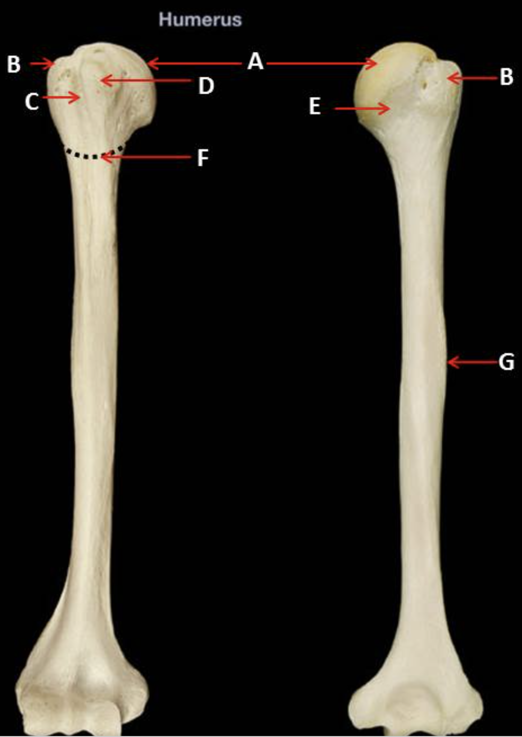 Solved Using the drop boxes below, identify the following | Chegg.com