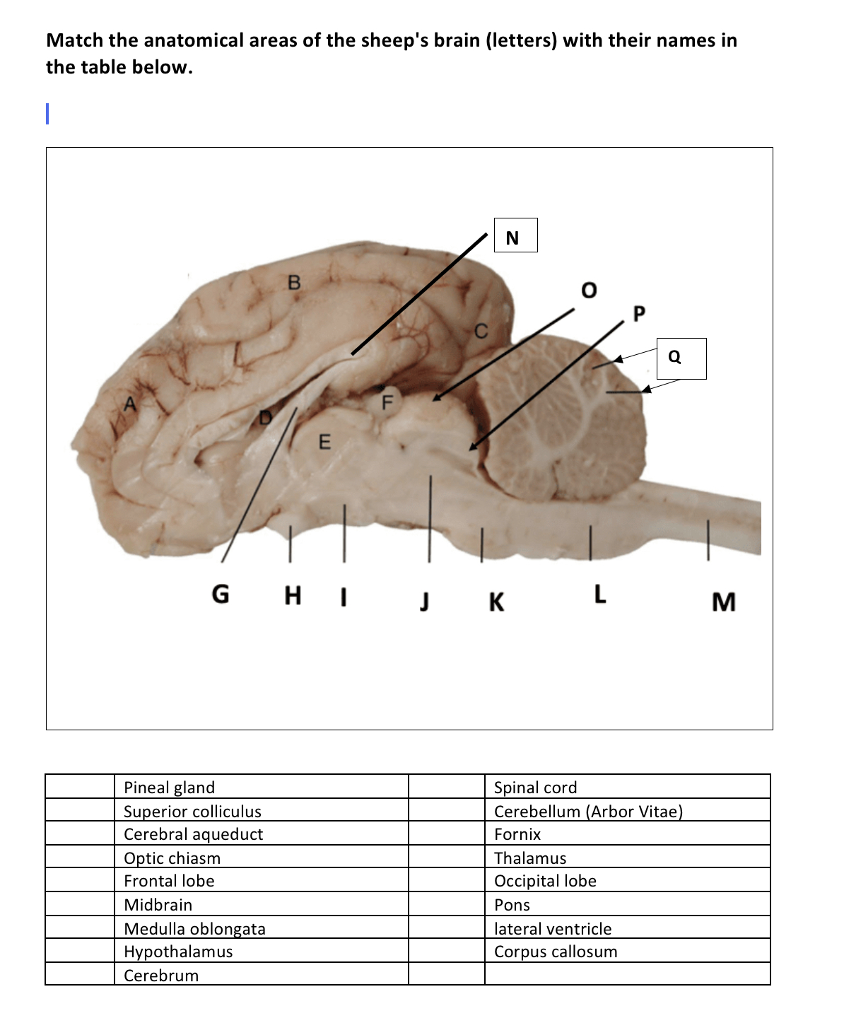 Solved Match the anatomical areas of the sheep's brain | Chegg.com