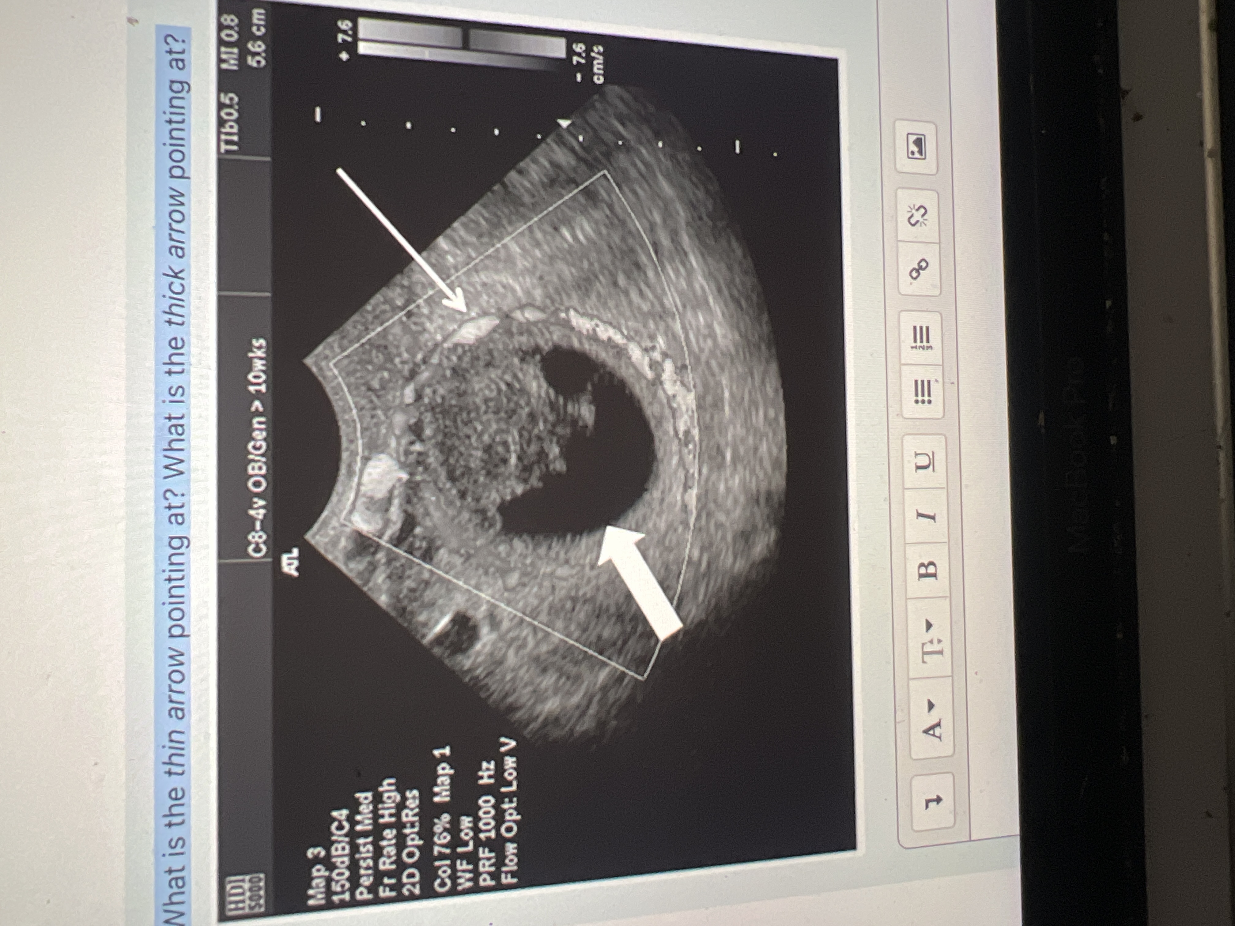 Solved What is the thin arrow pointing at? ﻿What is the | Chegg.com
