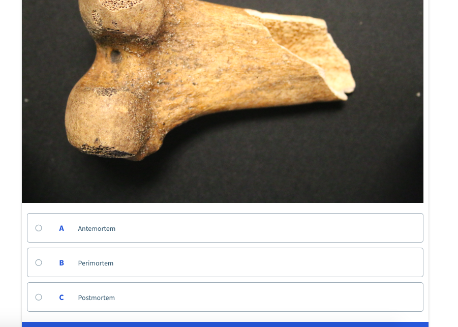 Solved Practice 2 Describe the timing of the fracture to the | Chegg.com