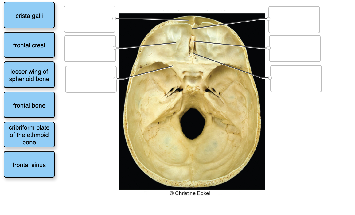 Solved crista galli frontal crest lesser wing of sphenoid | Chegg.com