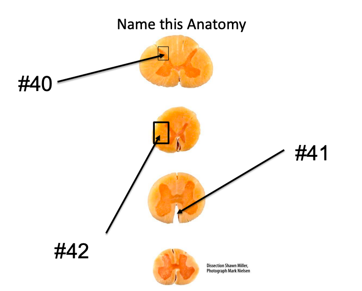 Solved Name this Anatomy #40 #41 #42 Dissection Shawn | Chegg.com