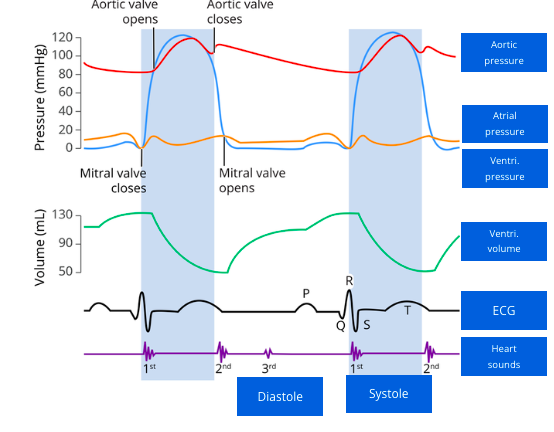 Solved Look at the atrial pressure tracing. What event | Chegg.com