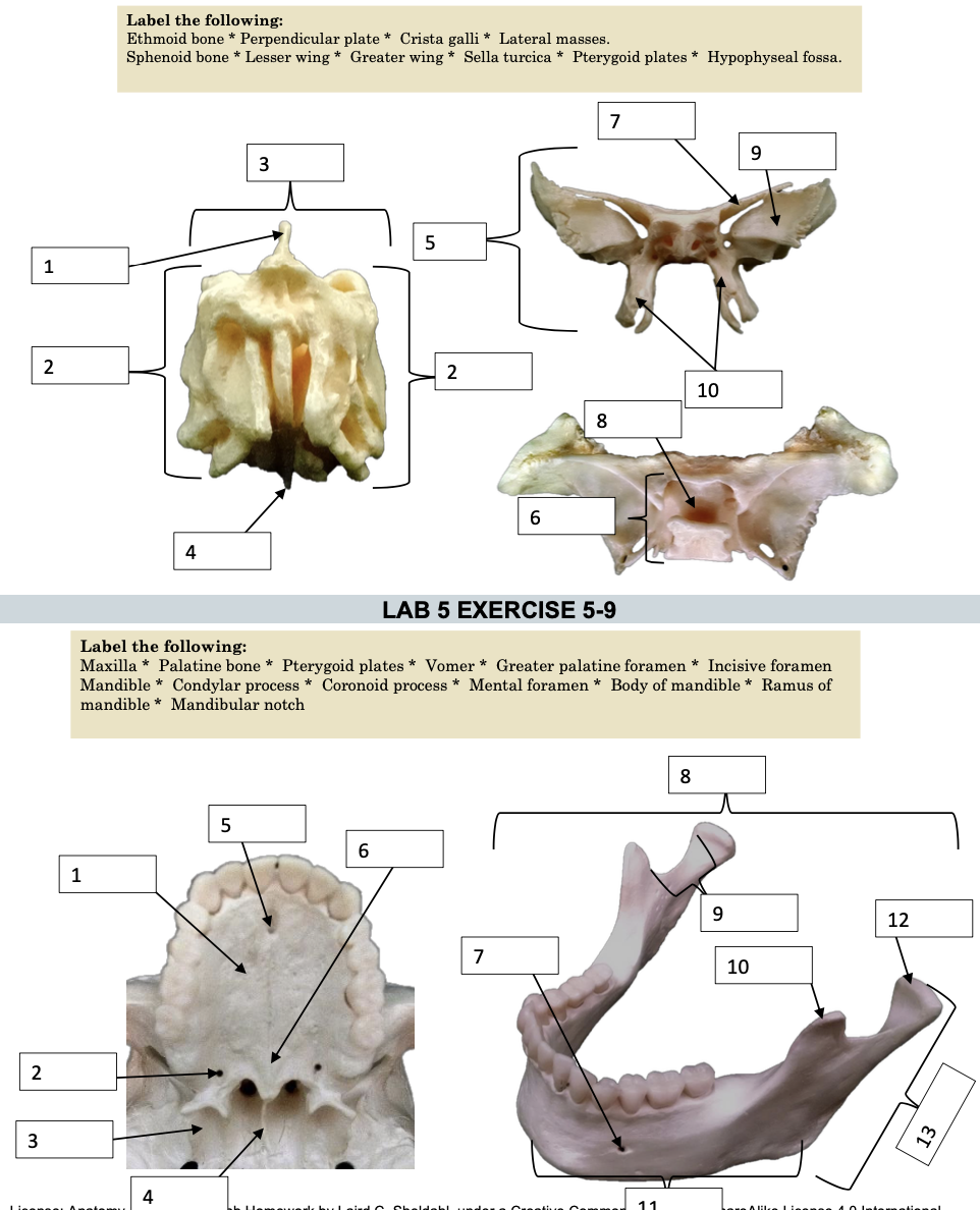 Perpendicular Plate And Vomer